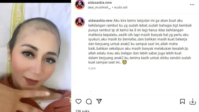 Aida Saskia Kembali Kehilangan Rambut Lebatnya saat Jalani Kemoterapi ...