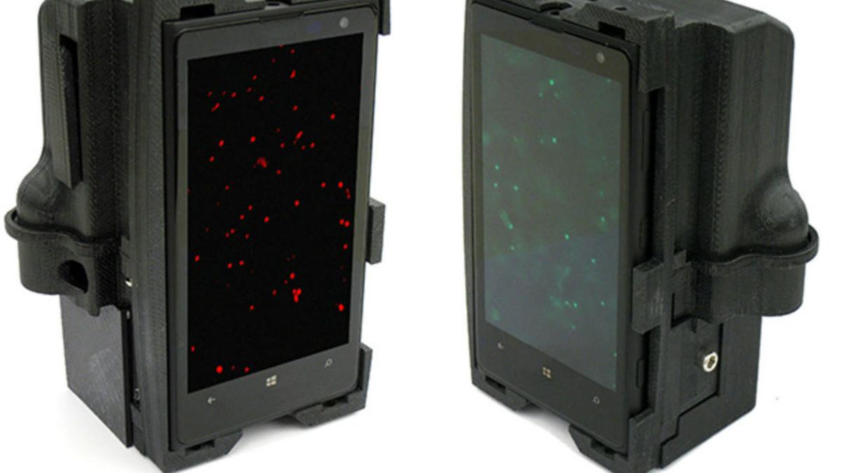 Alat Ini Rubah Kamera HP Jadi Mikroskop Pendeteksi Tuberkulosis ...