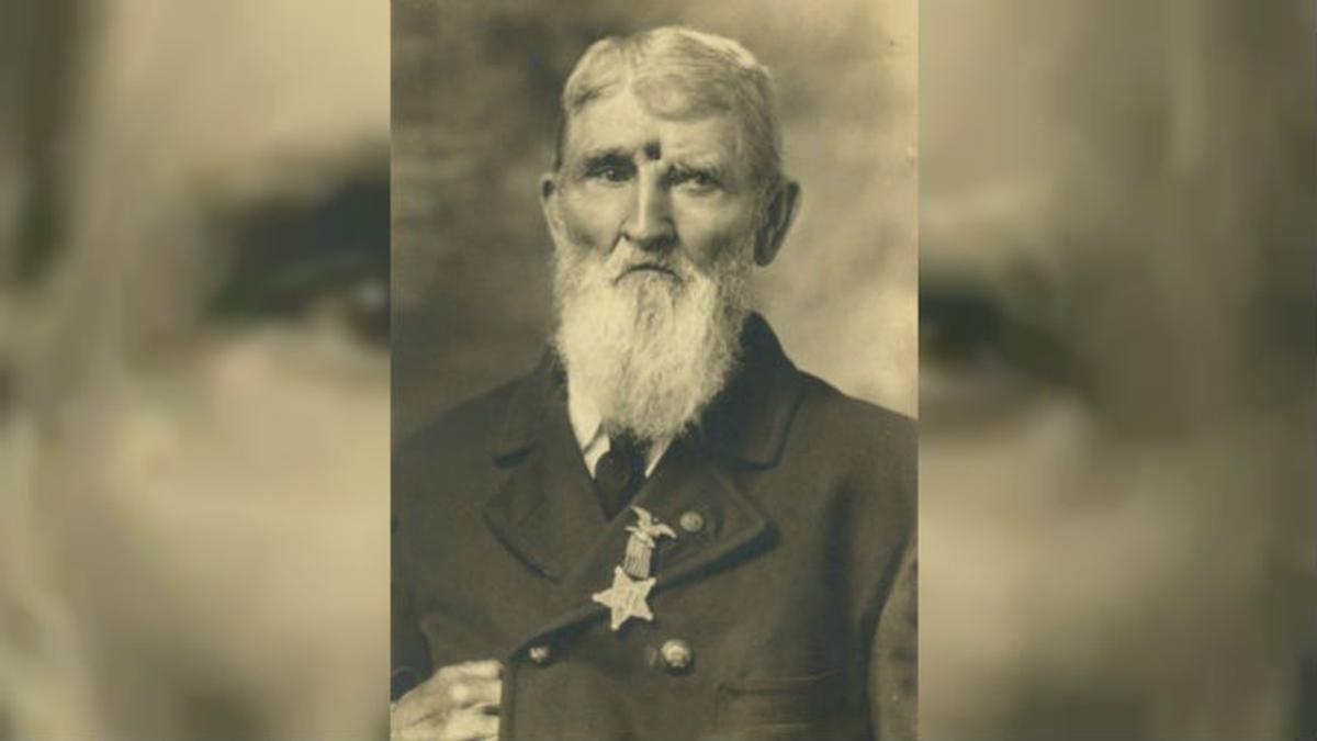 Selama 31 Tahun, Sebutir Peluru Bersarang di Kepala Prajurit Ini ...