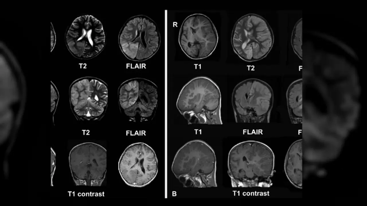 MRI adalah Teknologi Pemeriksaan Medis, Berikut Ulasannya - Hot ...