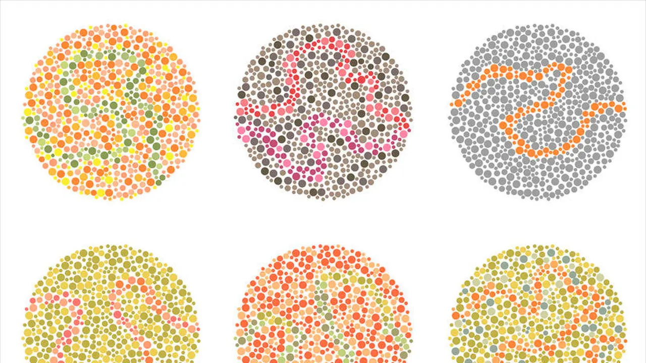 Gejala Buta Warna, Penyebab, dan Penanganannya yang Tepat - Hot ...