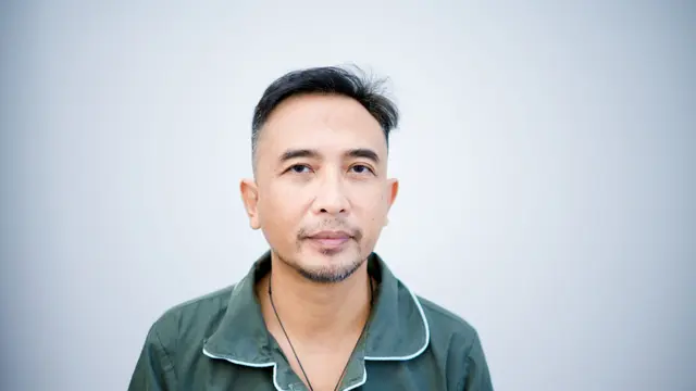 Piyu Padi Reborn Tak Pakai Topi Lagi setelah Transplantasi Rambut, Kini Menjalani Tahap Kedua ...