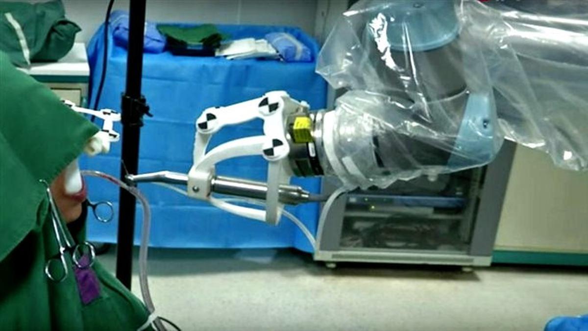 Robot di Tiongkok Sukses Lakukan Operasi Gigi pada Pasien - Health ...