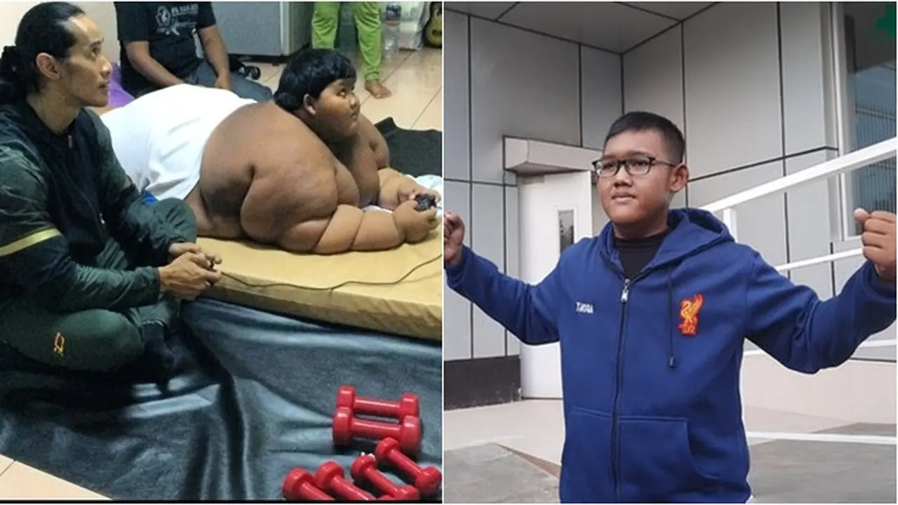 6 Potret Kabar Arya Permana Bocah Obesitas Hampir 200 Kg, Kini Kurus ...