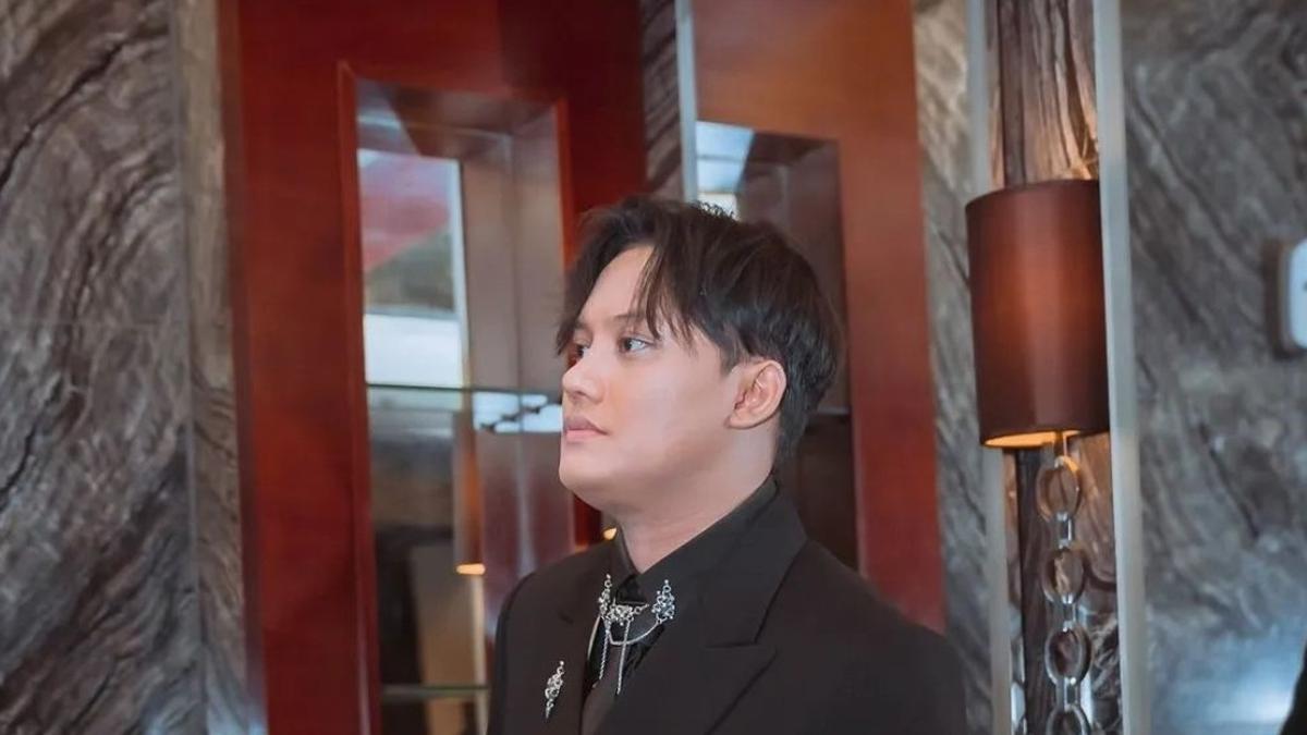 Potret Terbaru Rizky Febian Pasca Diduga Oplas Hidung, Disebut Mirip ...