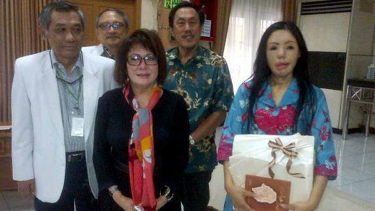 Inilah Wajah Lisa Sekarang Setelah 17 Kali Operasi Wajah