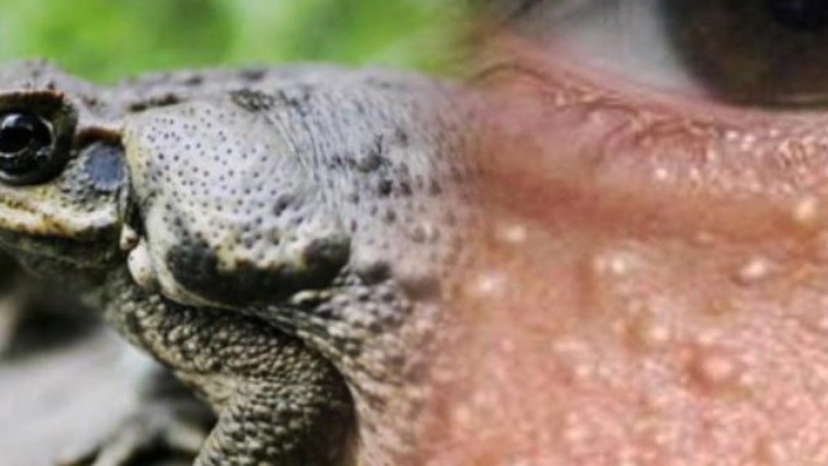 Diduga Disantet, Tubuh Wanita Ini Bruntusan Bak Kulit Katak Usai Dua ...