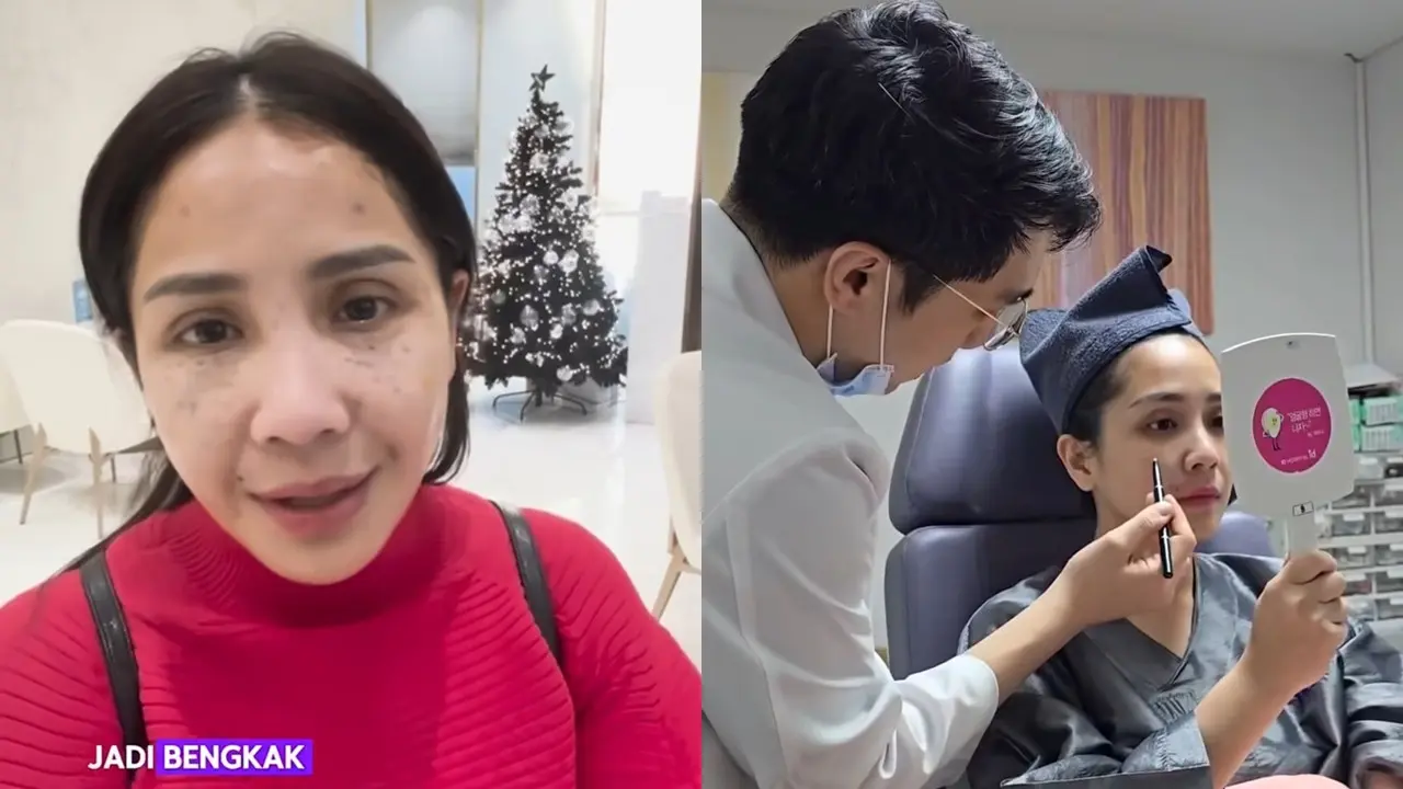 Malu Pulang ke Jakarta, Ini 7 Potret Wajah Bengkak Nagita Slavina di Korea Selatan - Hot ...