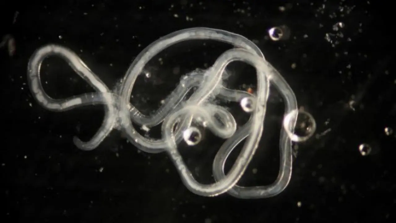 Seniman Ini Ciptakan Lukisan Menakjubkan dari Cacing yang Menginfeksi ...