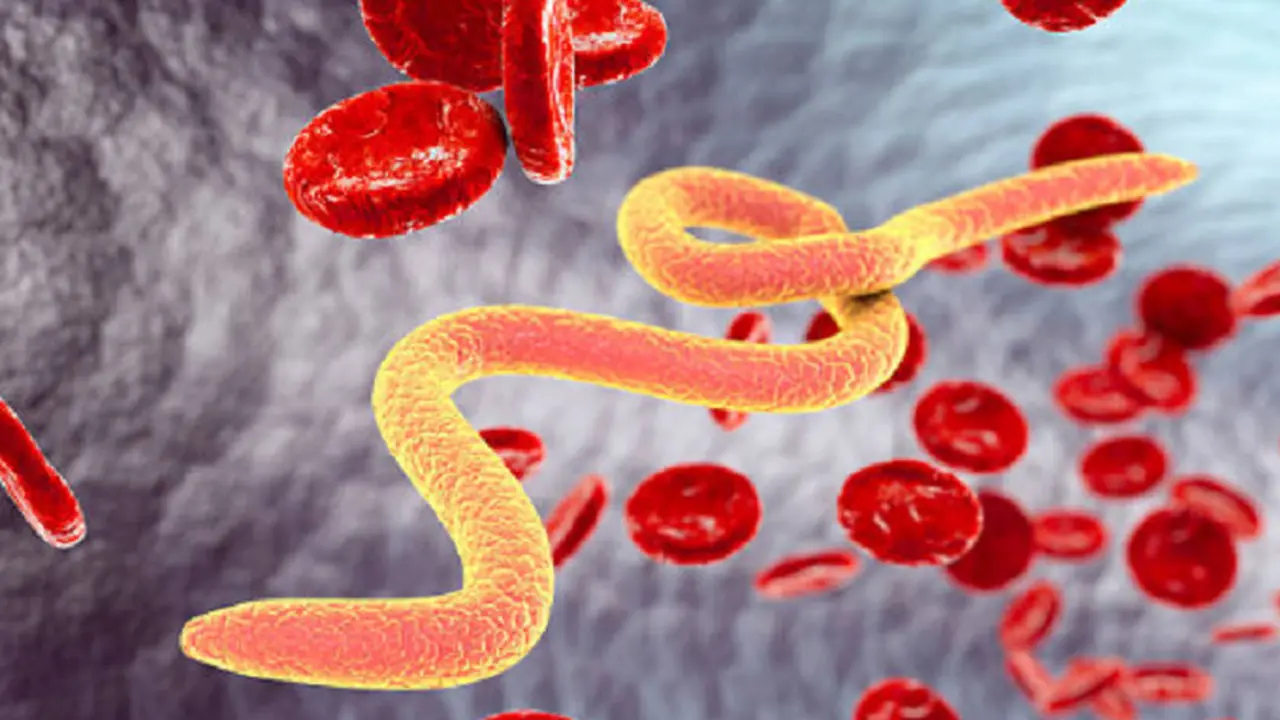 Gejala Cacingan Pada Anak dan Orang Dewasa yang Perlu Diwaspadai ...