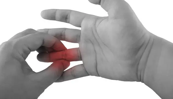 15 Ciri Batuk Berbahaya yang Perlu Diwaspadai, Ketahui Pencegahannya - Feeds Liputan6.com