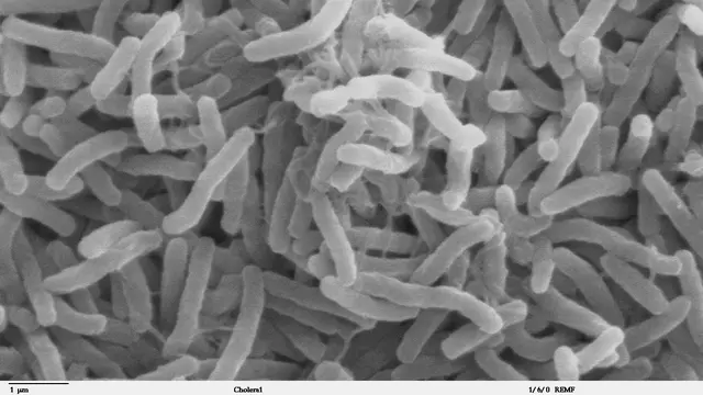 Salah Satu Penyebab Penyakit Kolera Pada Penduduk Adalah Sanitasi Buruk ...