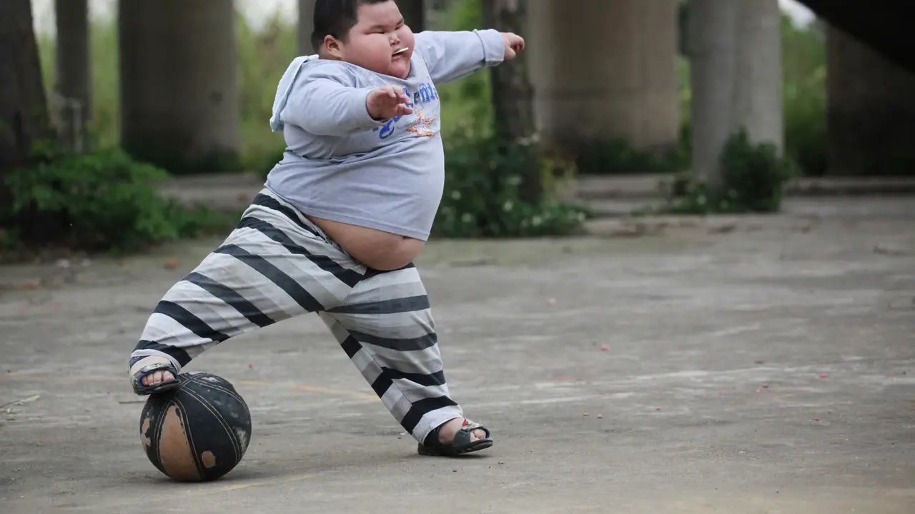 7 Penyakit yang Bisa Timbul Akibat Obesitas pada Anak, Termasuk Jantung ...