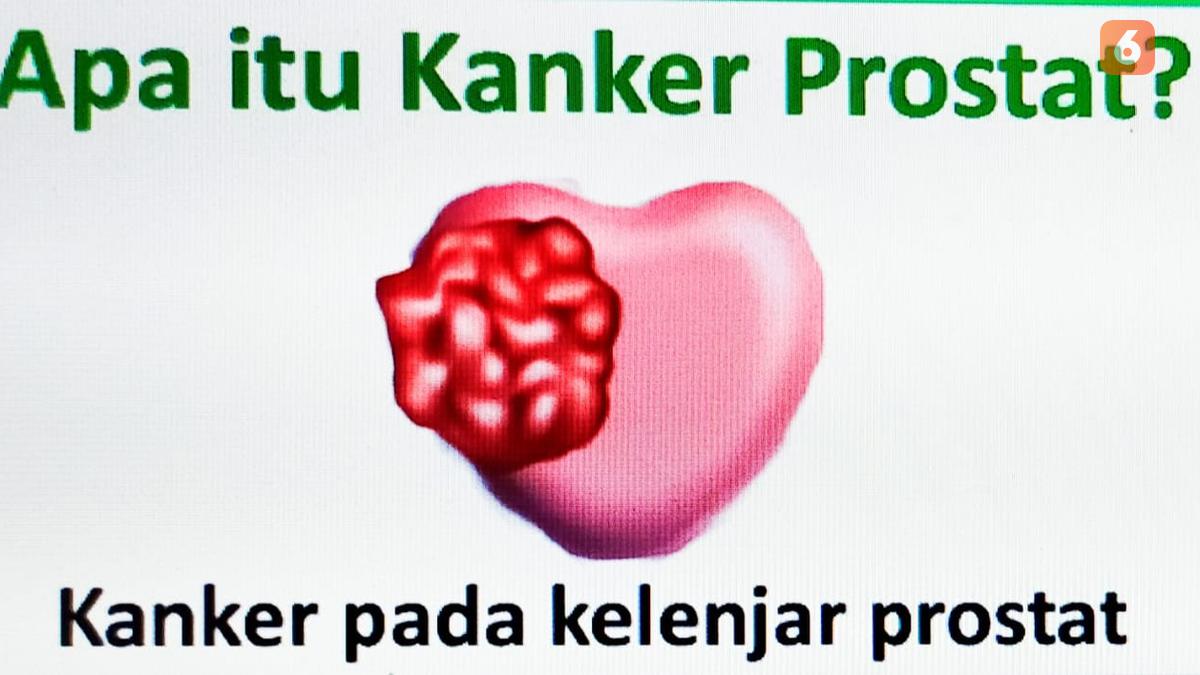 Mengenal Kanker Prostat, Penderitanya Keempat Terbanyak di Dunia ...