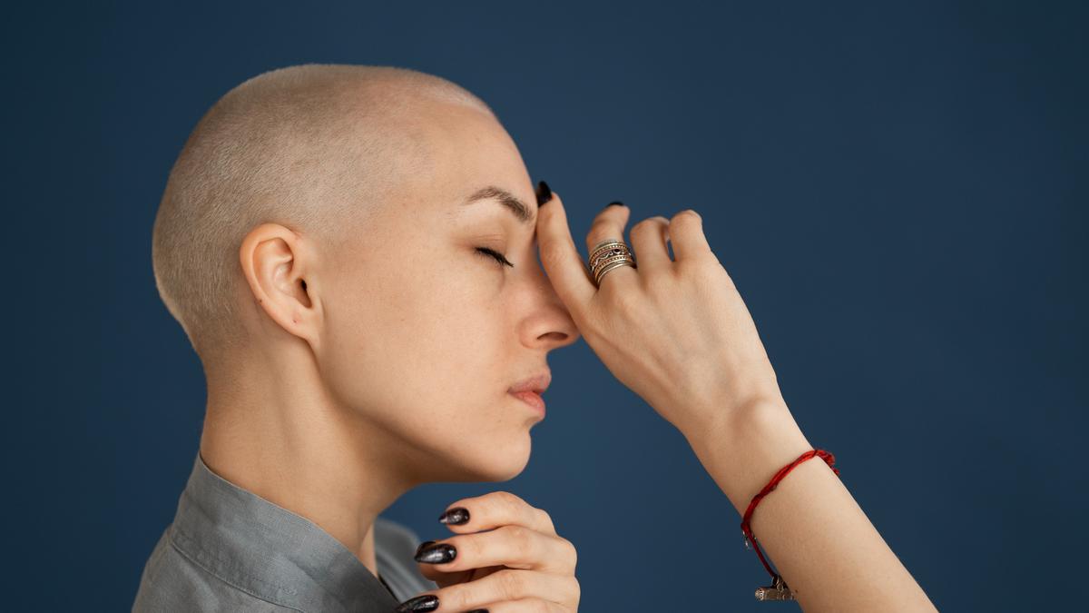 Penyebab Kebotakan Pada Wanita dan Cara Mengatasinya