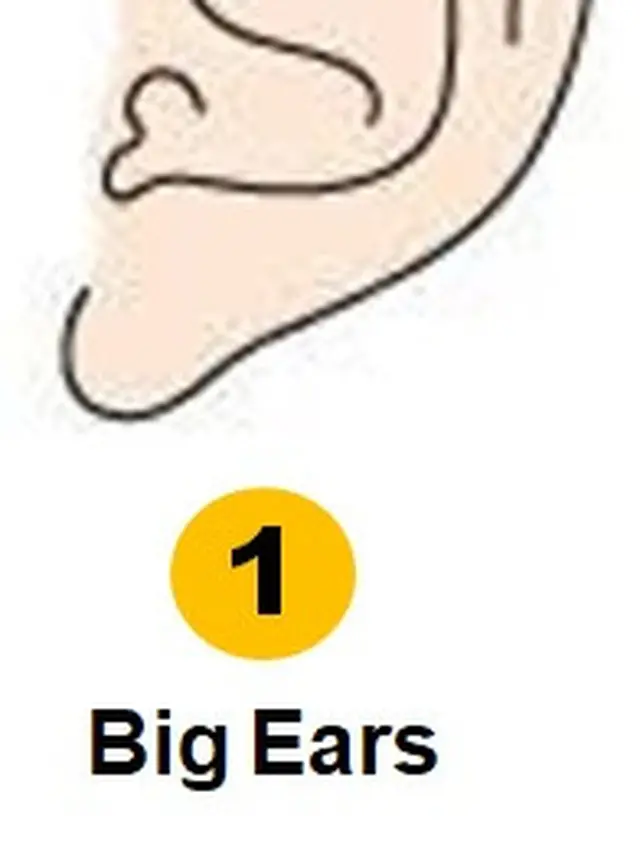 Ketahui Kepribadian Lewat Bentuk Telinga, Punya Kamu yang Mana ...