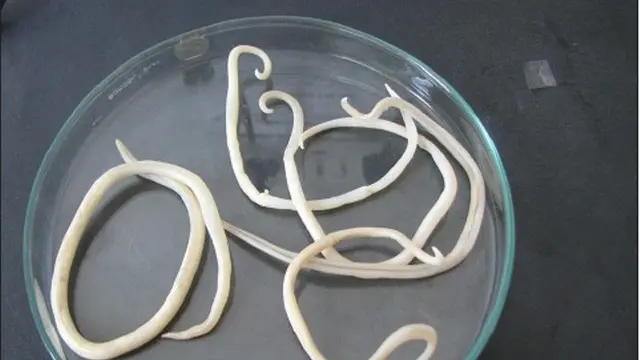 Mengenal Cacing Gelang yang Menginfeksi Raya Bocah Sukabumi, Panjangnya ...