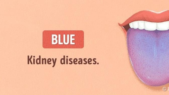 8 Warna Lidah yang Jelaskan Kondisi Kesehatan Anda - Health Liputan6.com