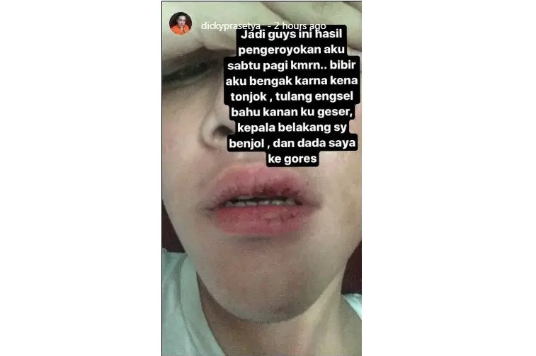 Pengeroyok Dicky SMASH Diduga Pengunjung Kelab Malam yang Mabuk ...
