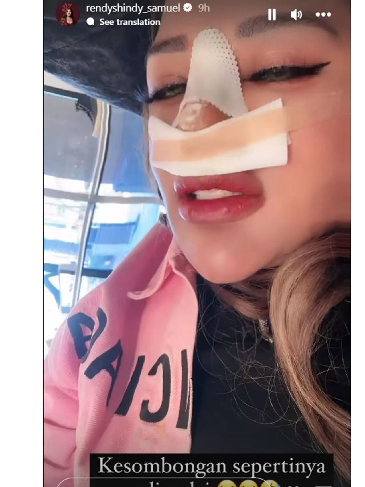 6 Potret Shindy Samuel Jalan-Jalan di Amerika Usai Oplas, Hidung Masih Diperban - Hot Liputan6.com