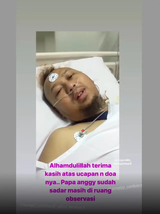 Patah Tulang, Anggy Umbara Diprediksi Baru Bisa Berjalan 6 Bulan Lagi ...