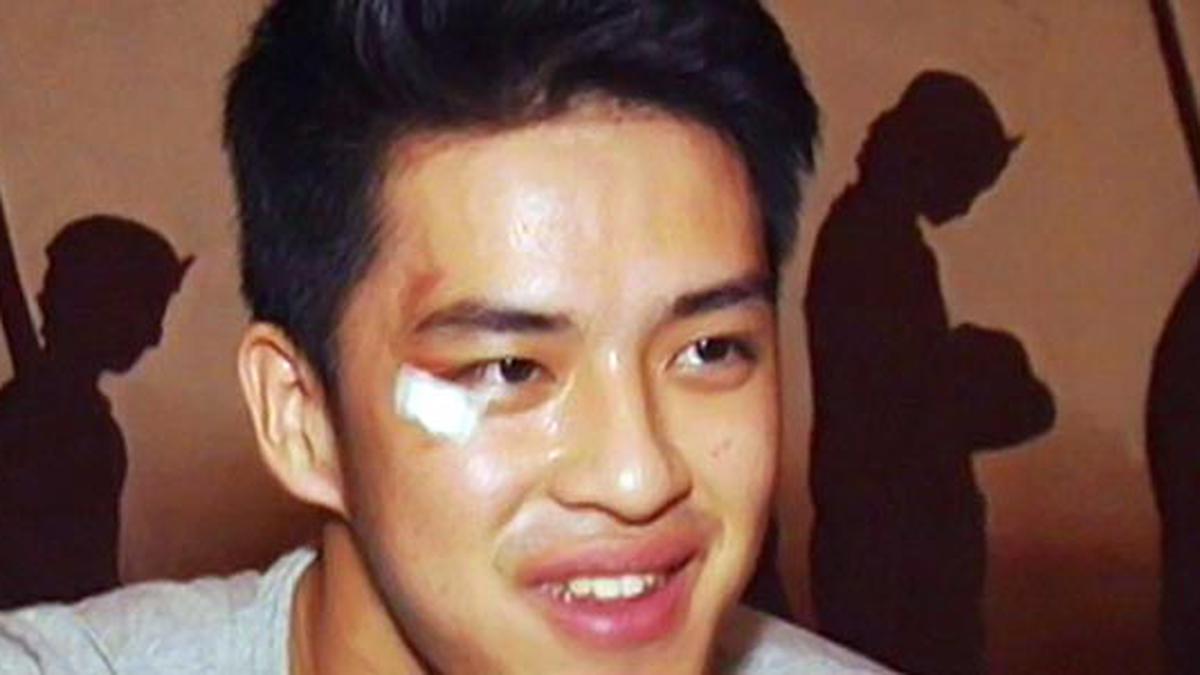 Ini Penuturan Morgan SMASH soal Kecelakaan - Video Liputan6.com