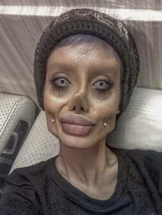 PHOTO: Ingin Mirip Angelina Jolie, Gadis Iran Ini Operasi Wajah 50 Kali ...