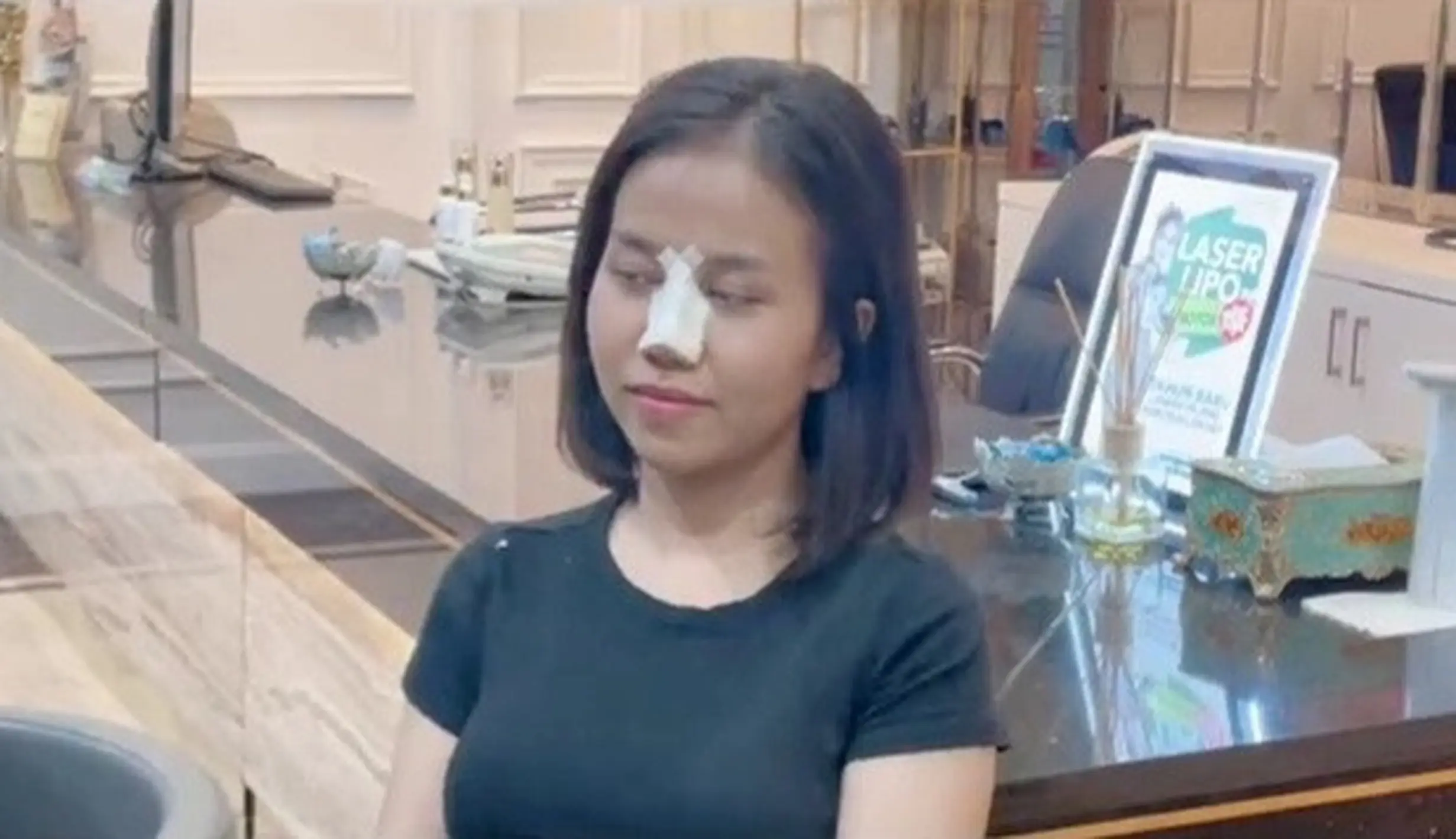 6 Potret Before-After Mayang Adik Vanessa Angel Operasi Hidung, Makin Cantik?