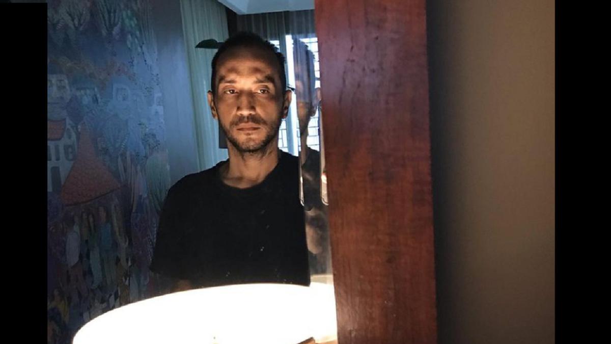 Gary Iskak Disebut Idap Kanker Hati, Ini Klarifikasi Keluarga soal ...