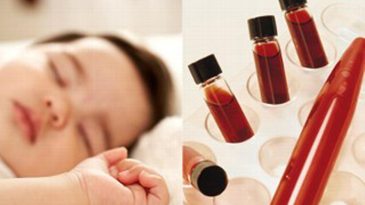Cegah dan Atasi Anemia pada Bayi dengan Cara Ini - Health Liputan6.com