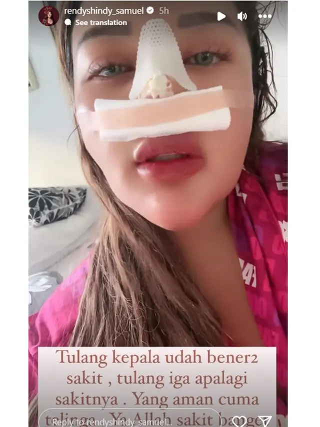 Setelah Operasi Bariatrik, Ini 6 Potret Shindy Samuel yang Kini Jajal Oplas Hidung - Hot ...