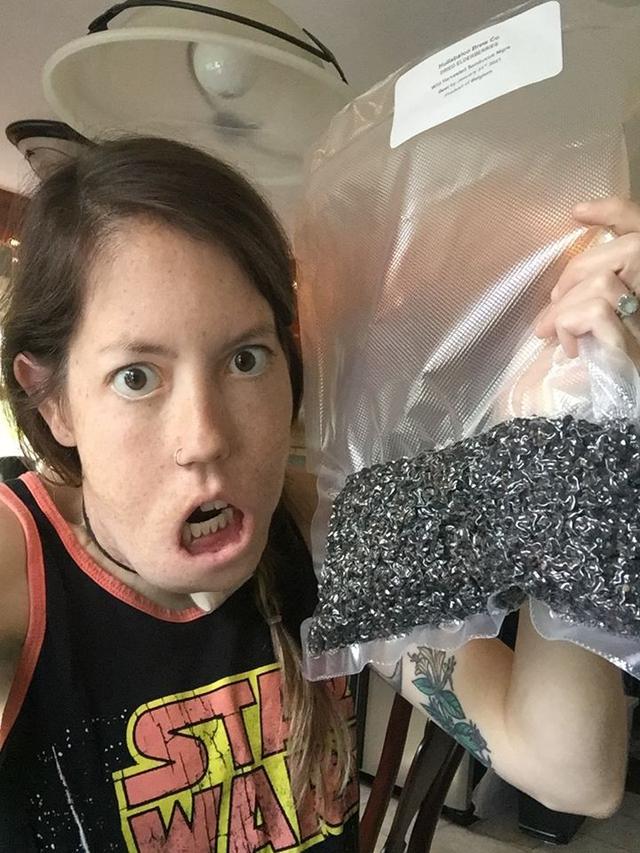 Derita Penyakit Langka, Wanita Ini Malah Jadi Advokat Hak Disabilitas ...