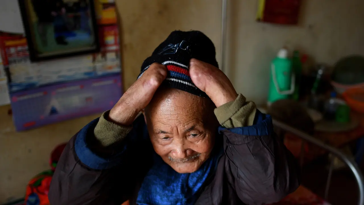 4 Penyebab Penyakit Kusta, Gejala, Jenis serta Cara Pengobatan yang ...