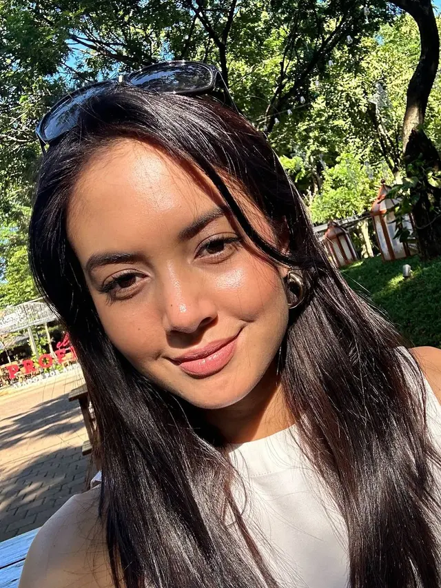 Kisah Aurelie Moeremans Pernah Disebut Dekil hingga Disarankan Suntik ...