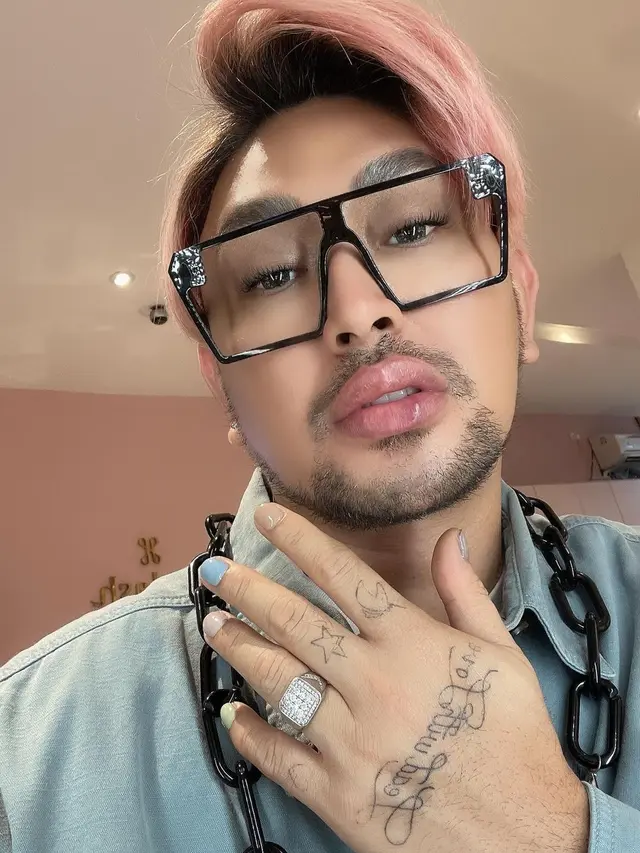 Caren Delano Punya Bibir Baru Berbentuk Hati Hasil Kreasi Dokter Ekles ...