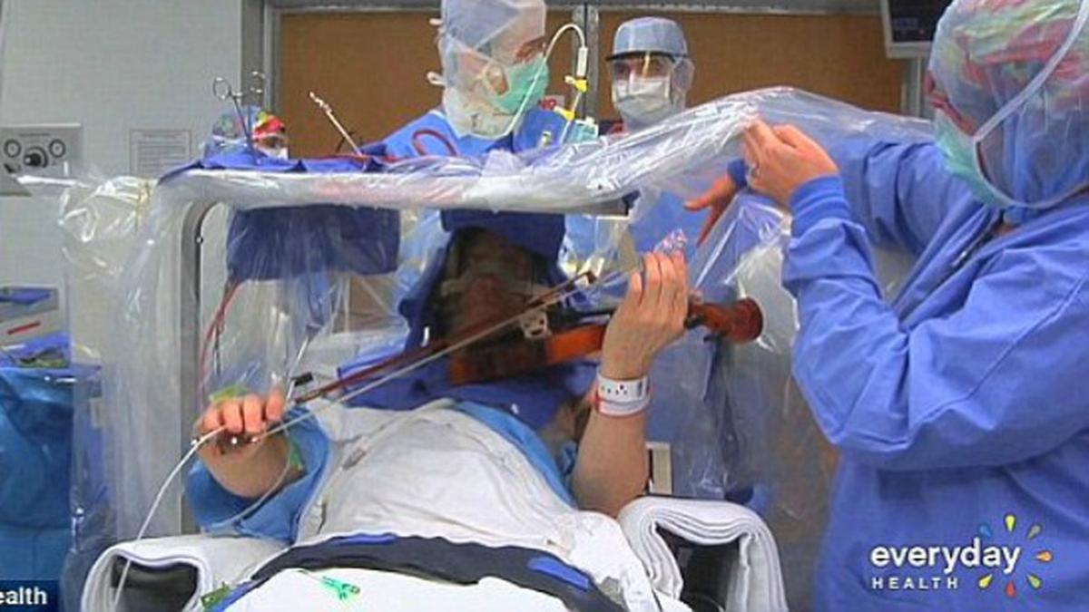 Pria Ini Mainkan Gitar dan Biola Saat Jalani Operasi Tumor Otak