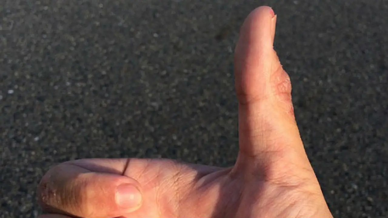 Ungkap Kepribadian dari Bentuk Jempol, Punya Kamu Bengkok atau Lurus ...