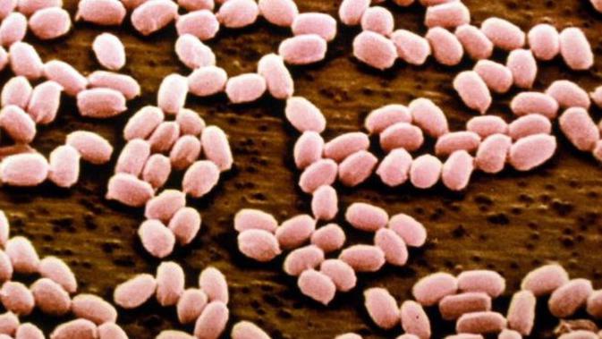 Begini Penularan Antraks ke Manusia - Health Liputan6.com
