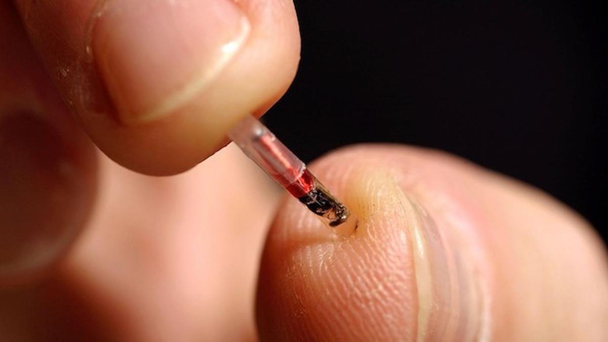 Perusahaan Ini Perkenankan Karyawan Pakai Chip Implan - Tekno Liputan6.com