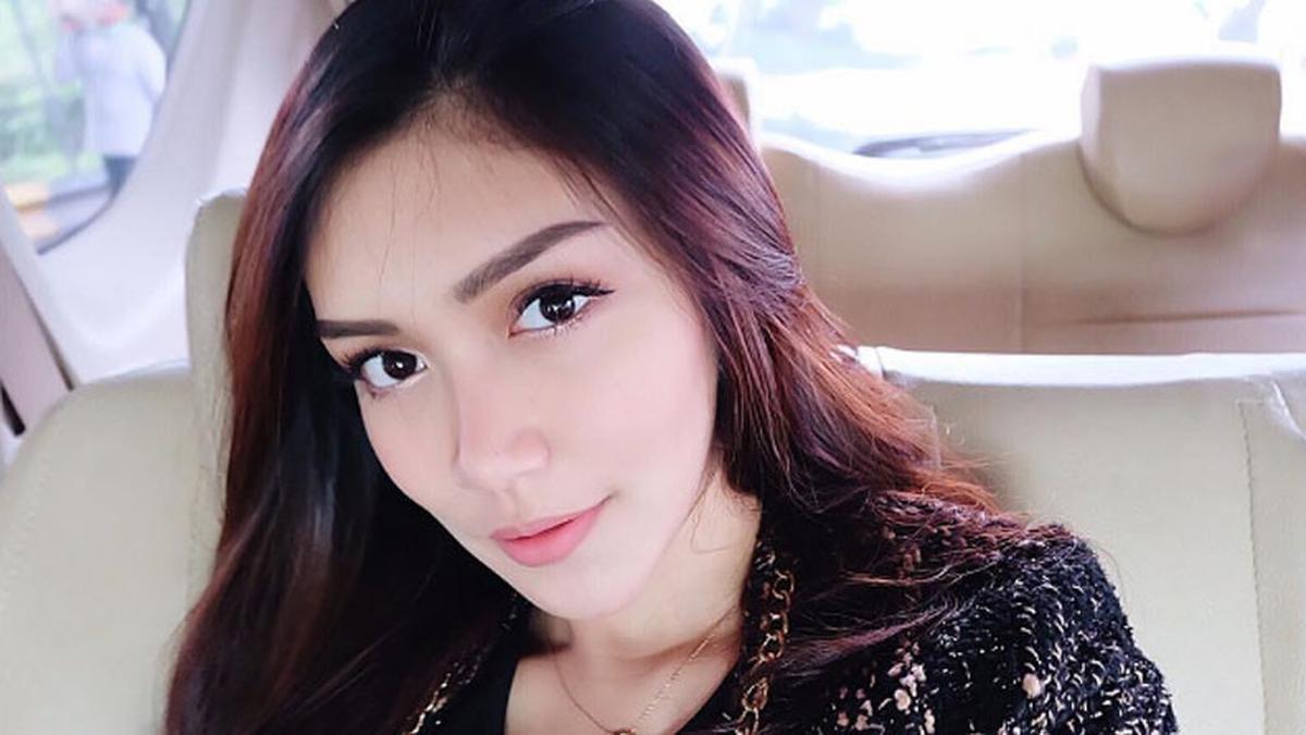 Bukan Operasi Plastik, Melody Prima Lakukan Ini pada Wajahnya - ShowBiz ...