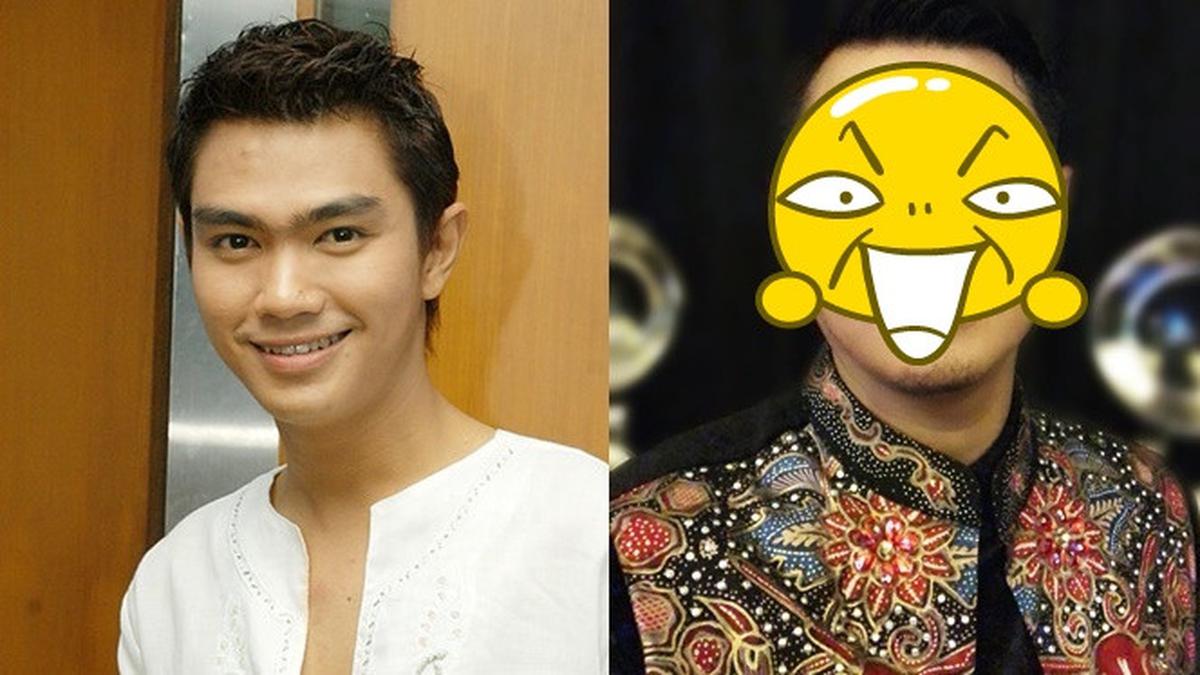 Ingat Micky AFI yang Jadi Juara 3? Ini 6 Potret Terbarunya Jadi ...