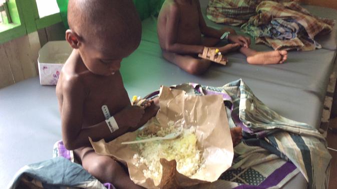 7.230 Anak Asmat Terindikasi Wabah Campak dan Gizi Buruk - Regional Liputan6.com