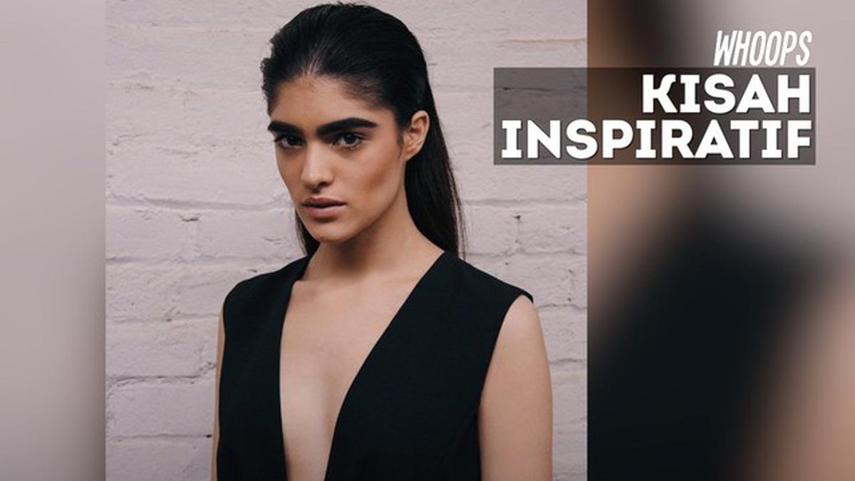 Whoops Kerap Di Bully Karena Alis Tebalnya Model Cantik Ini Buktikan Diri Video