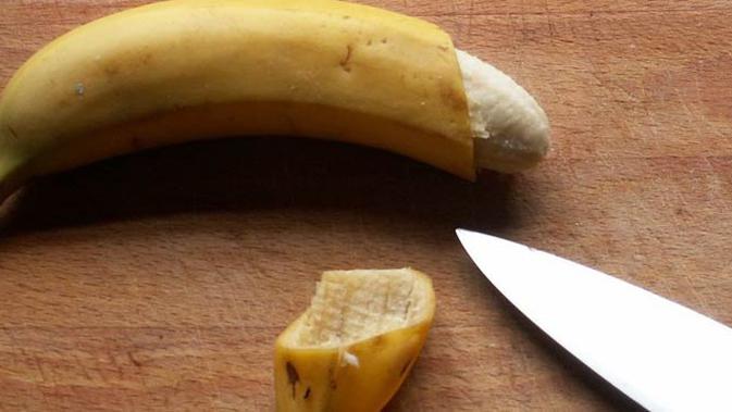 7 Manfaat Sunat bagi Kesehatan Pria - Health Liputan6.com