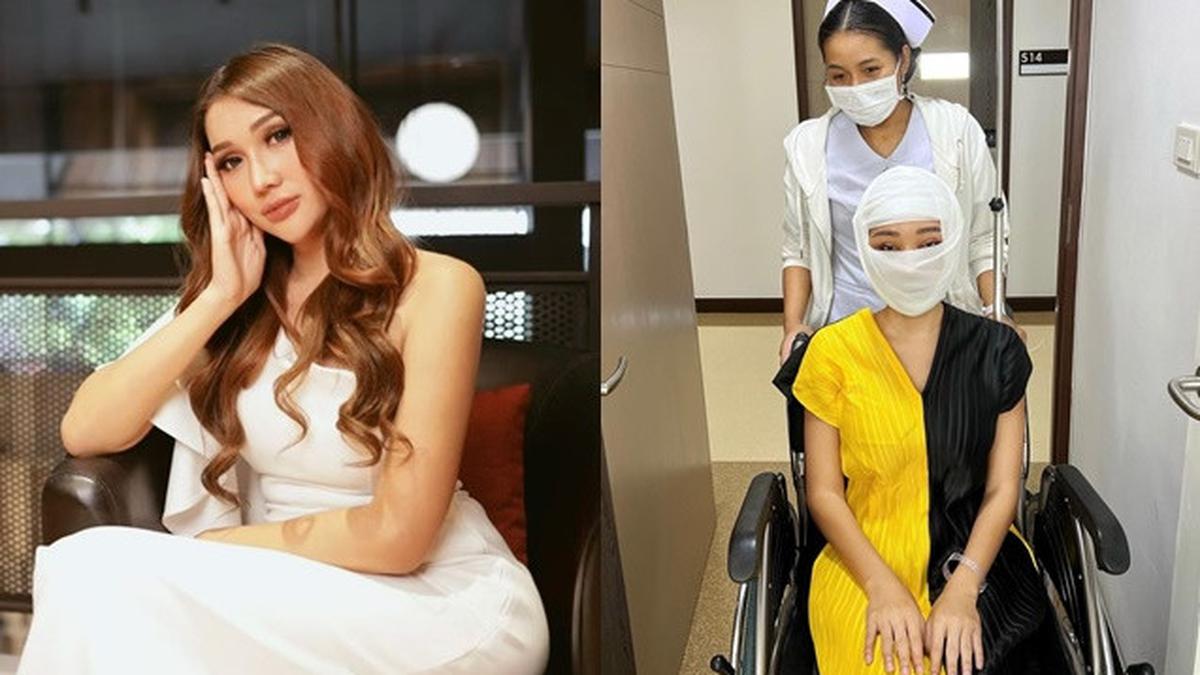 Lucinta Luna Diduga Lakukan Operasi Plastik, Ini 6 Potretnya dengan ...