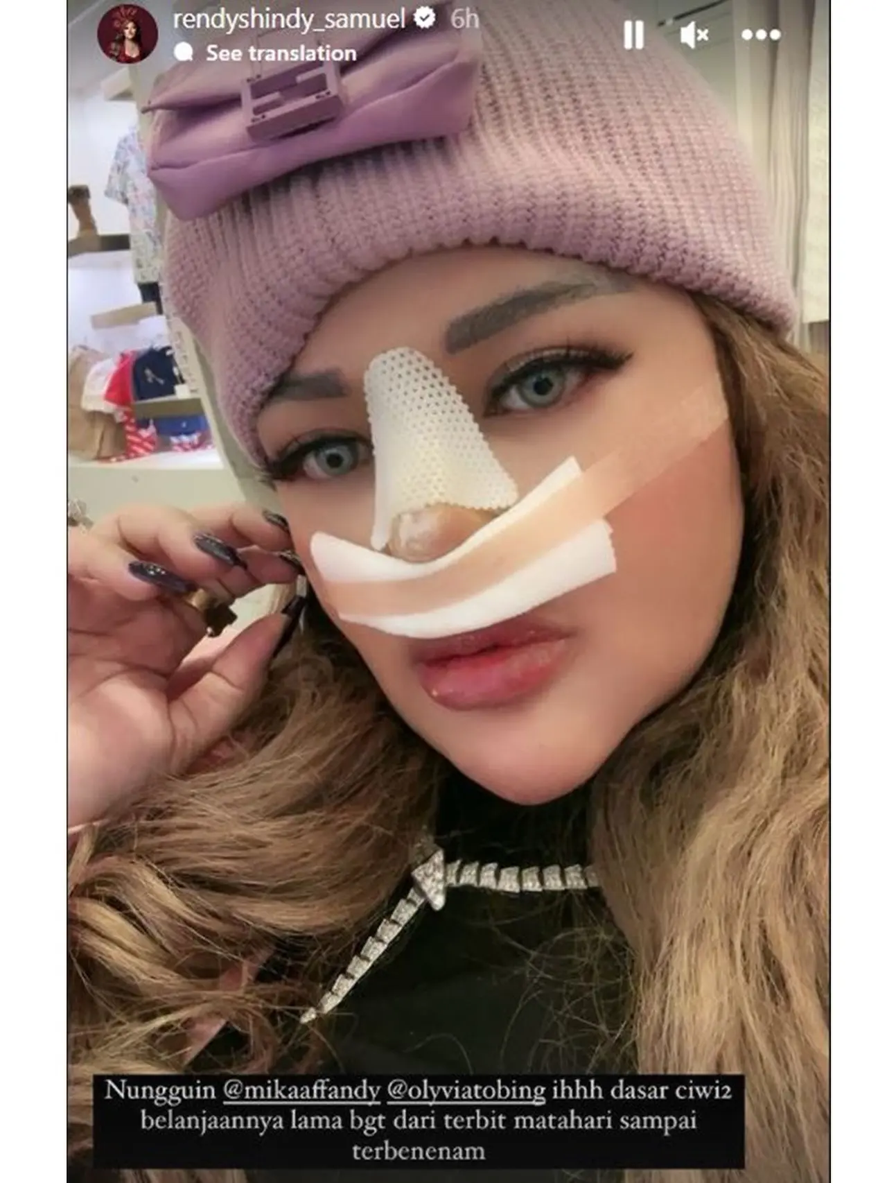 6 Potret Shindy Samuel Jalan-Jalan di Amerika Usai Oplas, Hidung Masih Diperban - Hot Liputan6.com