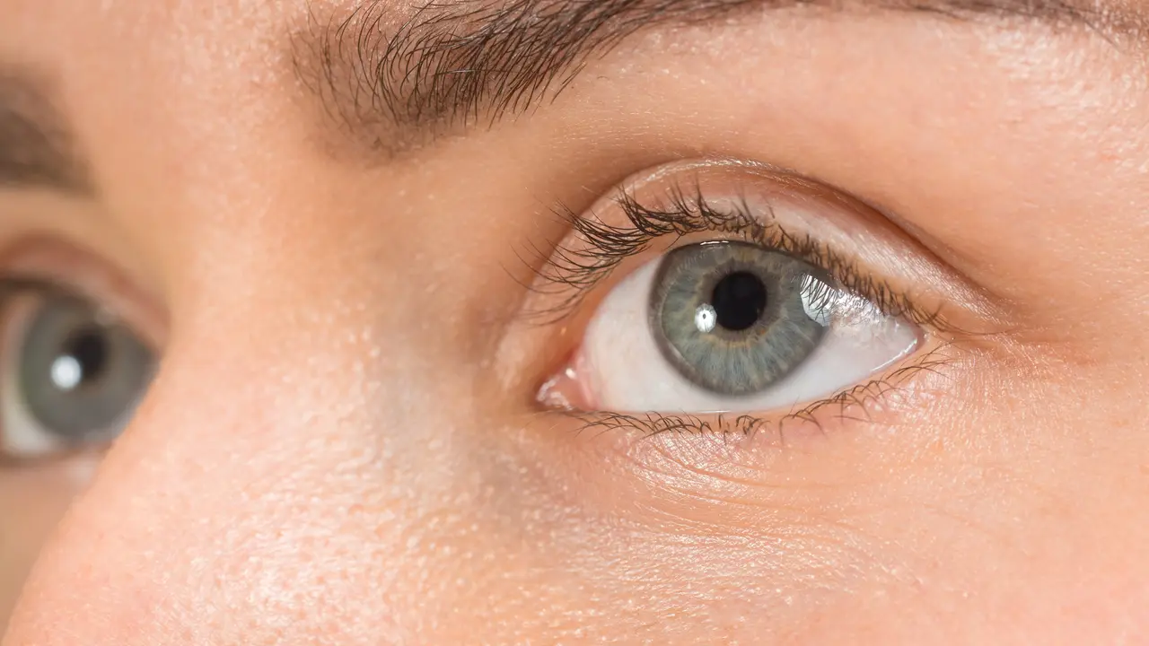 Mata Juling Bisa Pengaruhi Kemampuan Penglihatan, Kenali Penyebab ...