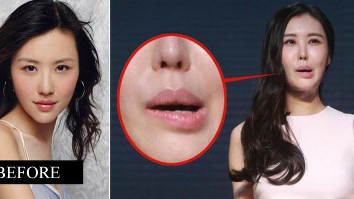 Efek Operasi Plastik Membuat Wajah Artis Ini Jadi Aneh - Beauty Fimela.com