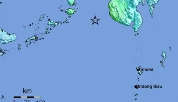 Deteksi Tanda dan Gejala Awal Stroke, Segera Lakukan Metode FAST ...