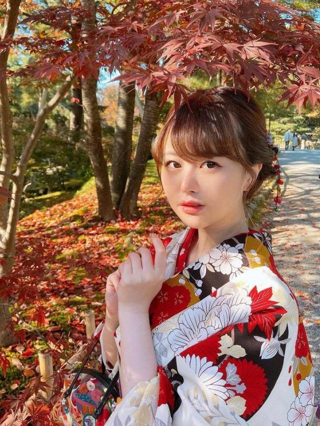 Diejek Buruk Rupa, YouTuber Ini Jalani Operasi Plastik Puluhan Kali ...